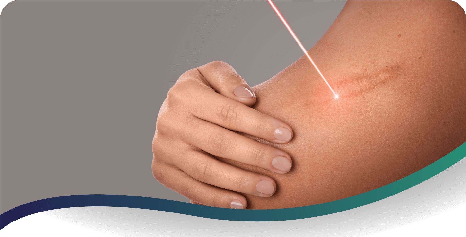 Deep Scar Removal Treatment in Hyderabad, Chennai, Bangalore