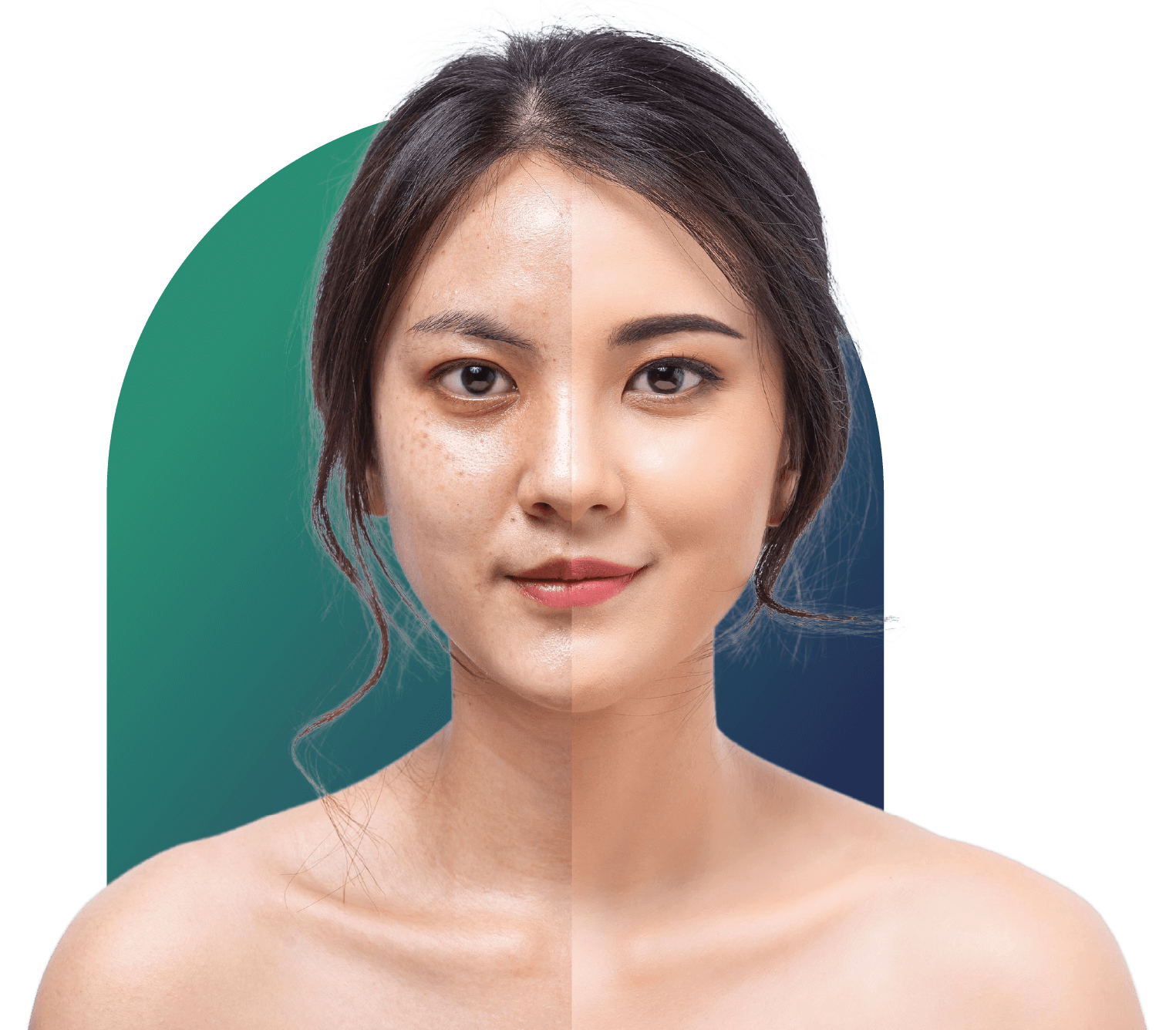 Skin Fairness & Whitening Treatment in Hyderabad, Bangalore, Chennai