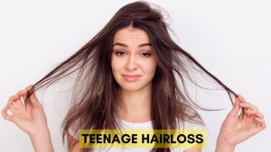 Teenage Hair Loss & Thinning: Treatment, Causes, Prevention