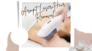 Underarm Laser Hair Removal:How It Works & What to Expect
