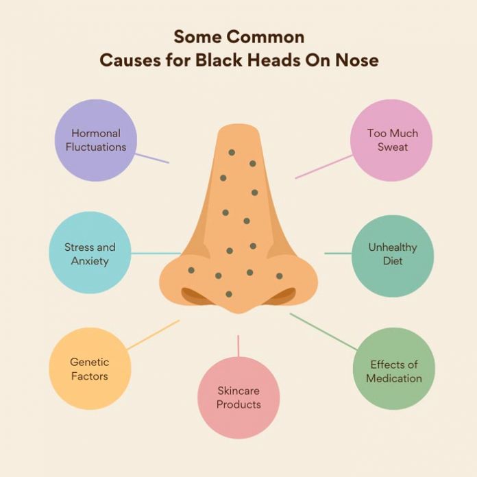 Blackheads on the Nose: Causes, Treatments, Prevention Blackheads on the Nose: Causes, Treatments, Prevention