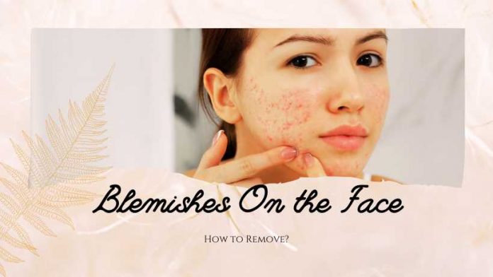How to Remove Blemishes On the Face: Skincare Tips