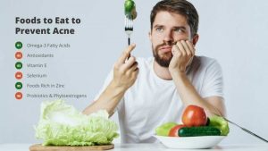 Anti-Acne Diet Guide: Best Foods for Pimple Free Skin