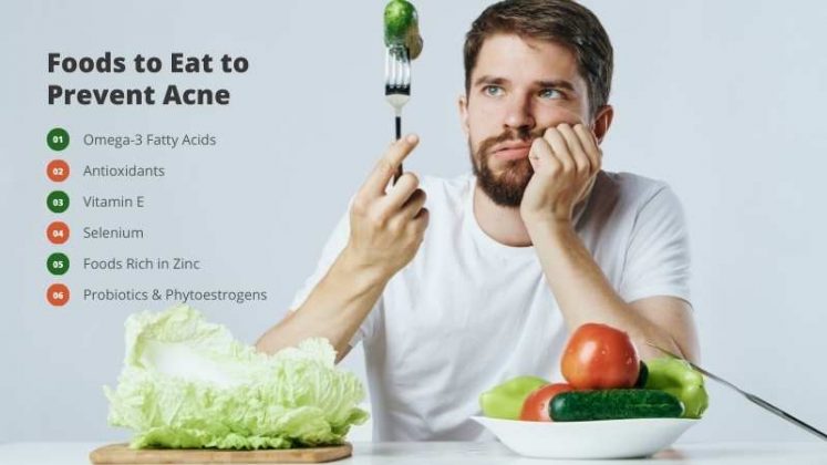 Anti-Acne Diet Guide: Best Foods for Pimple Free Skin